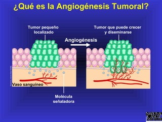 Entendiendo la Angiogénesis | PPT
