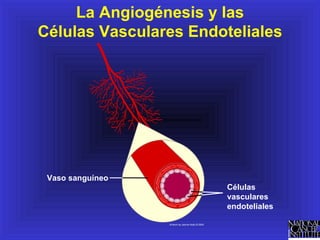 Entendiendo la Angiogénesis | PPT