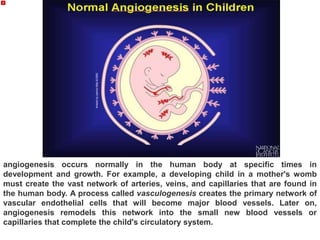Angiogenesis Overview | PPT