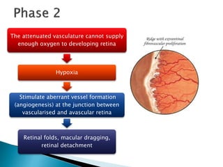 Angiogenesis in health and disease | PPTX