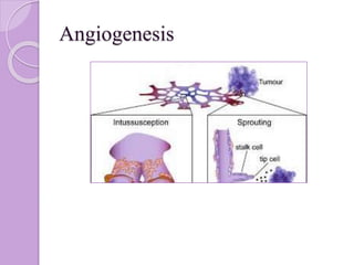 Angiogenesis | PPTX