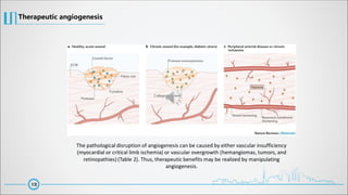 Angiogenesis | PPT