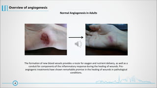 Angiogenesis | PPT