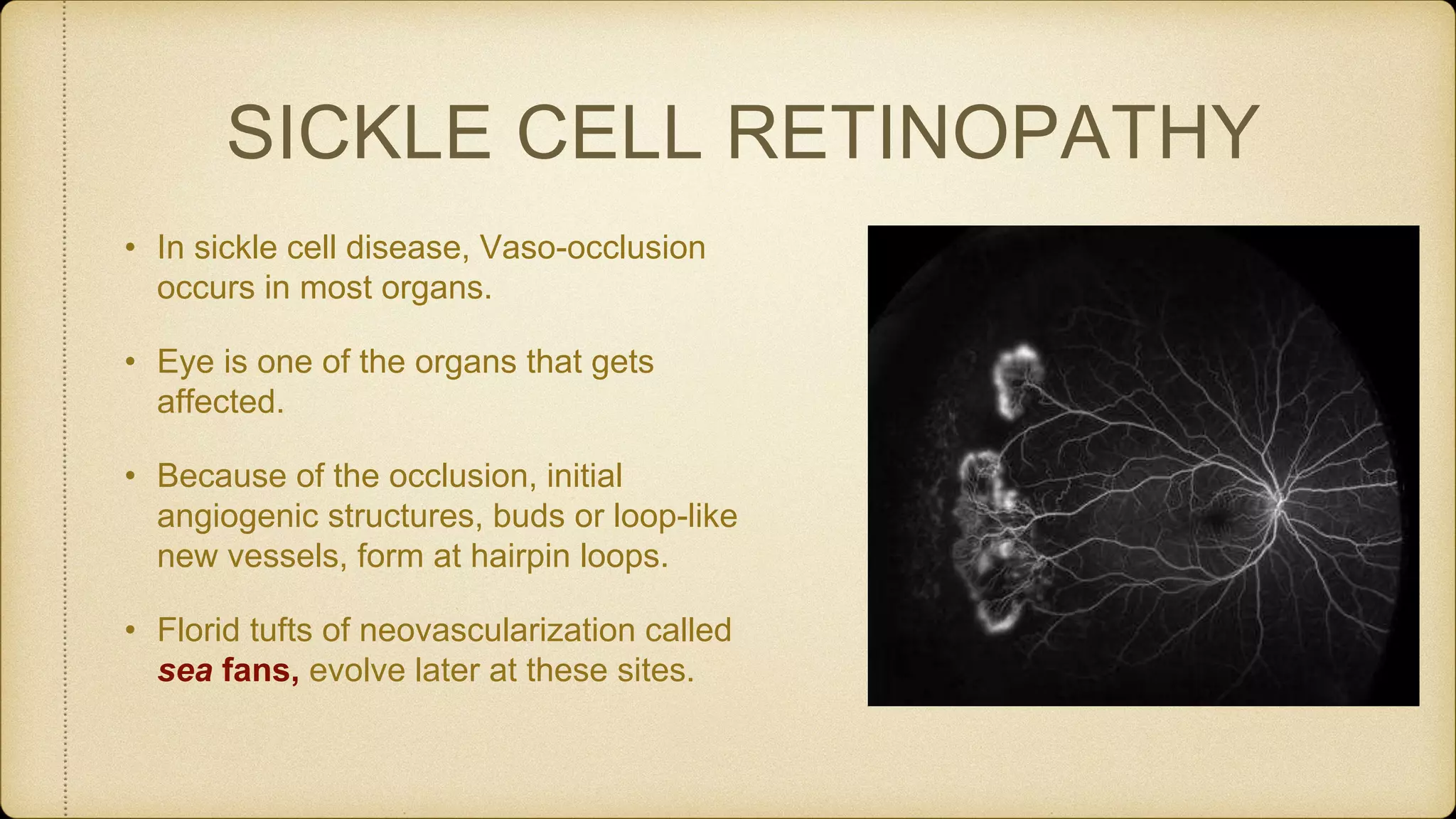 angiogenesis..pptx