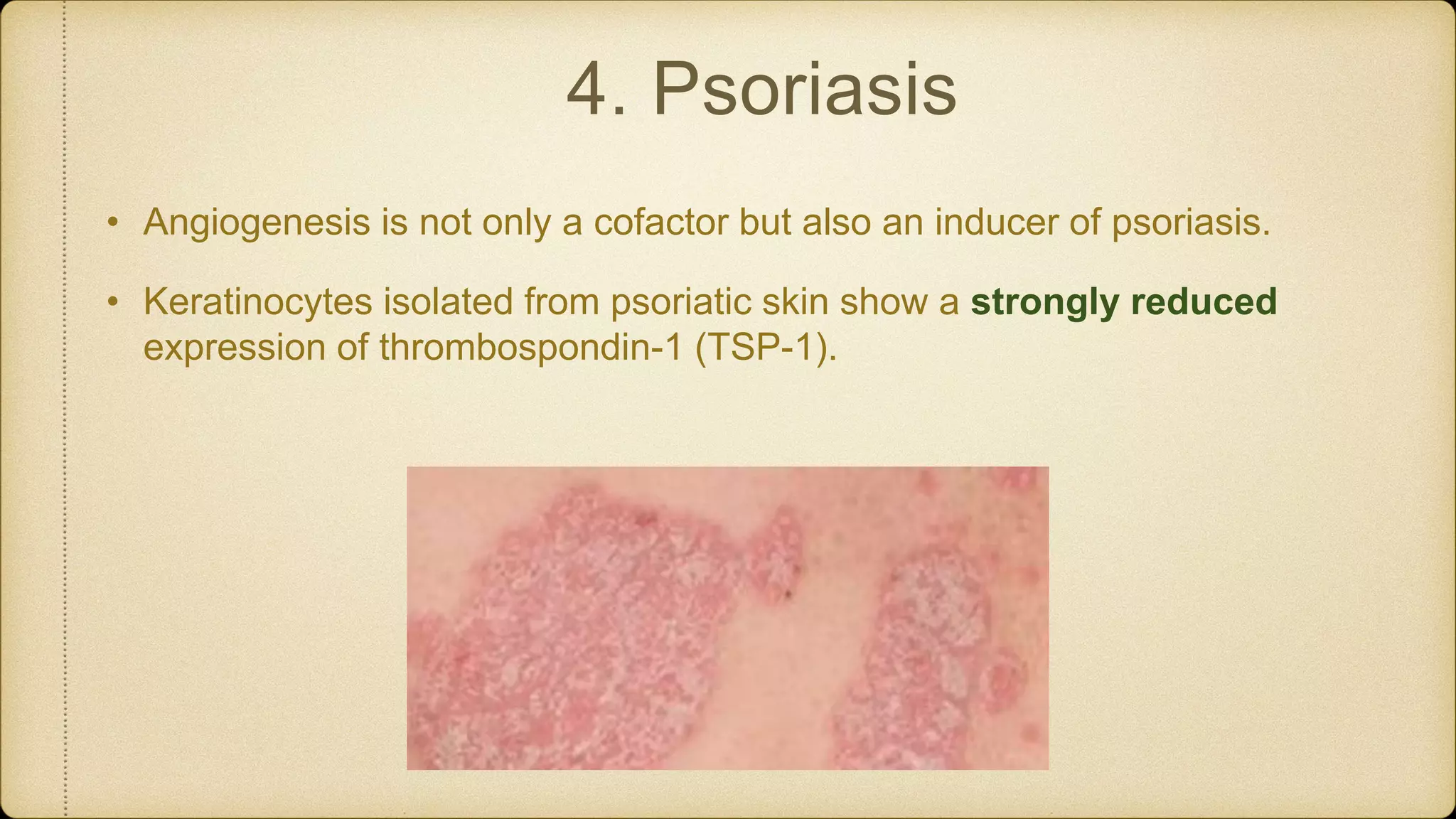 angiogenesis..pptx
