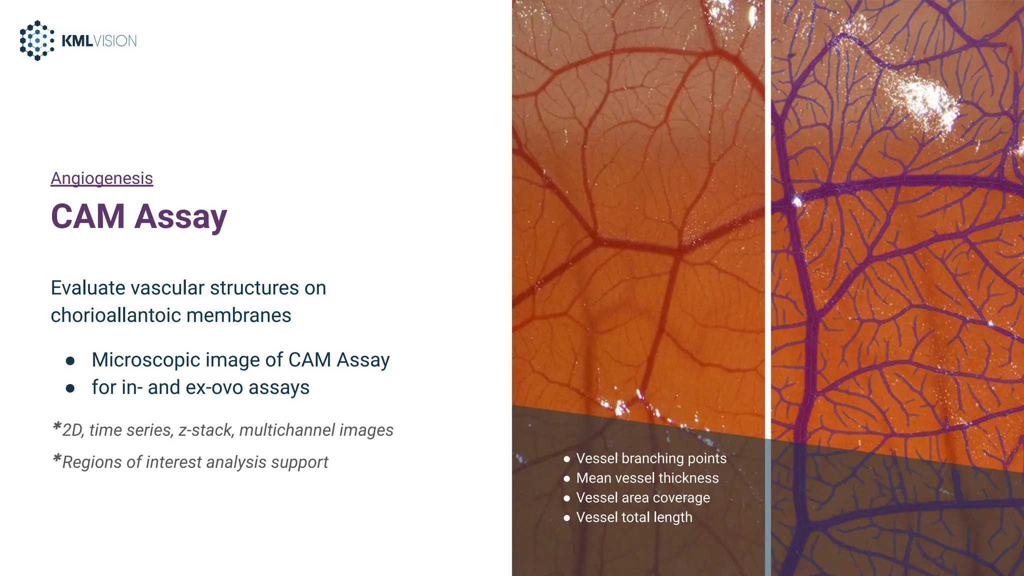 Angiogenesis Use Cases Solved with IKOSA | PDF