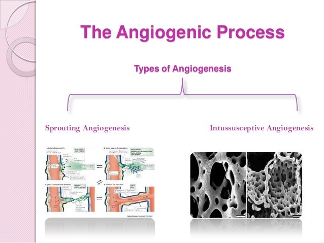 Angiogenesis, Introduction to Understand the Art.
