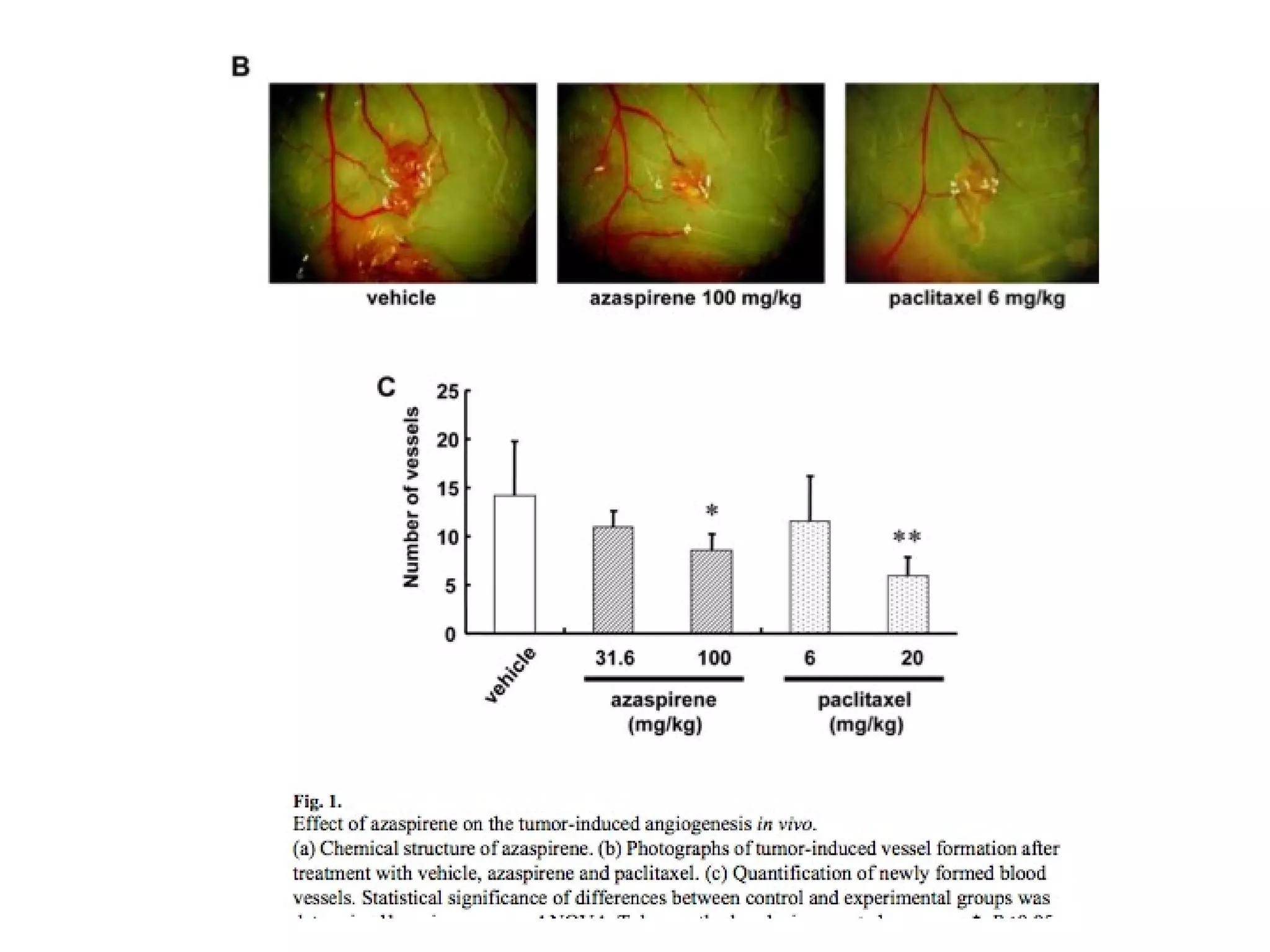 Angiogenesis invasion | PPT
