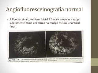 Angiografia fluorescente | PPTX