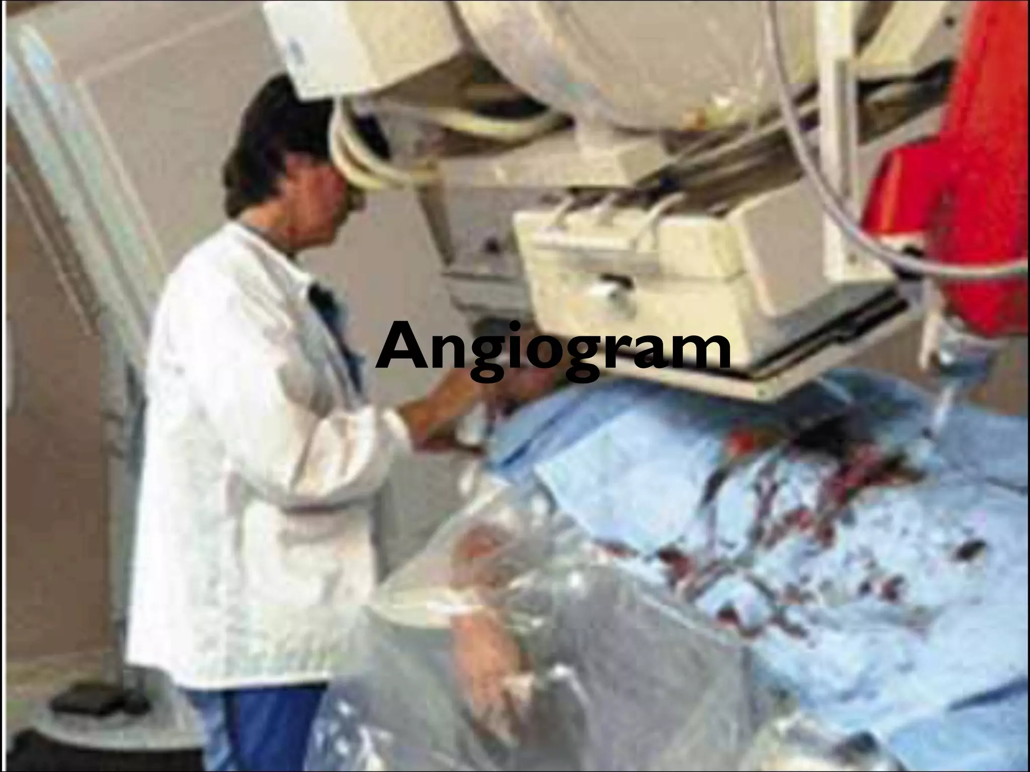 Angiogram | PPT