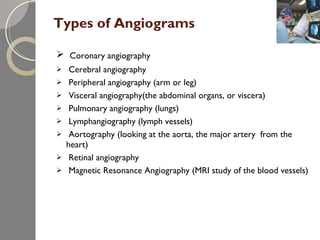 Angiogram | PPT