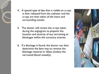 Angiogram | PPT