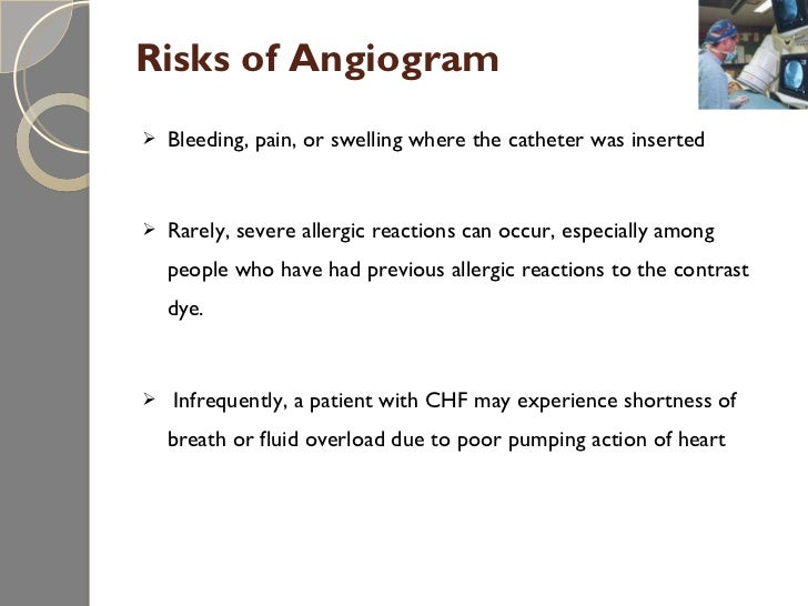 Angiogram