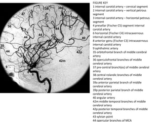 Angiografia Neurovascular | PPTX