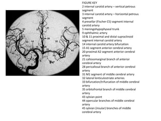 Angiografia Neurovascular | PPTX