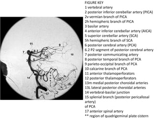 Angiografia Neurovascular | PPTX