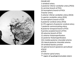 Angiografia Neurovascular | PPTX