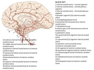Angiografia Neurovascular | PPTX