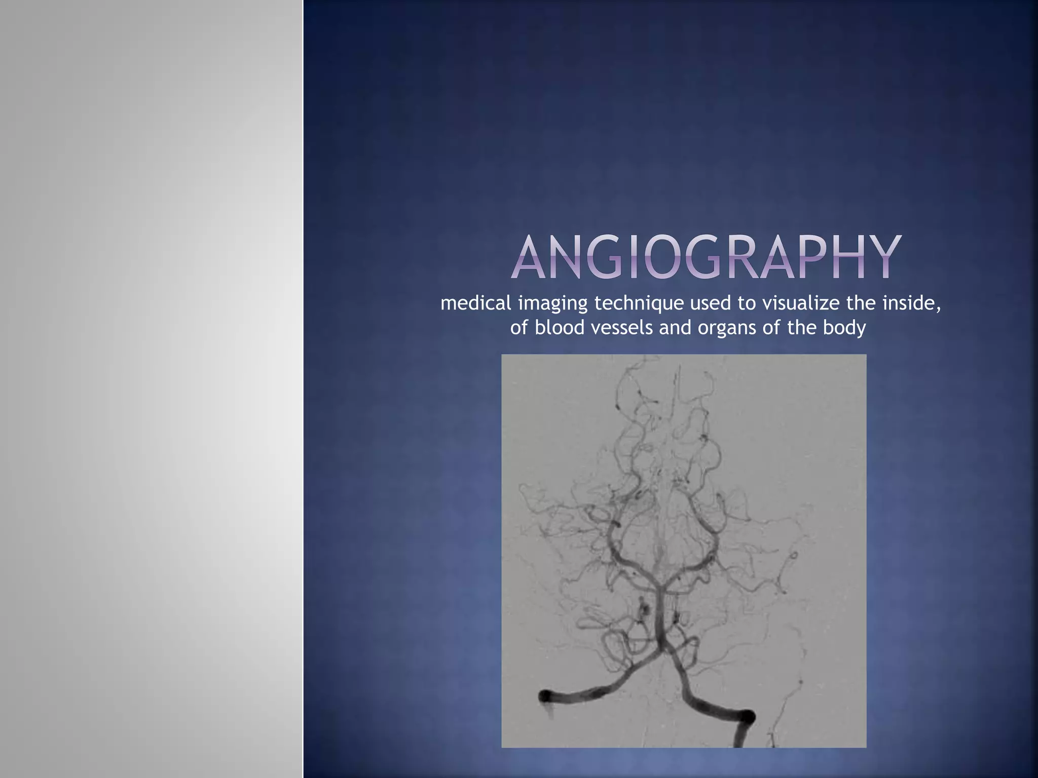 Angiography | PPTX