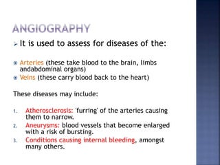 Angiography | PPTX