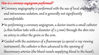 Angiography | PPTX