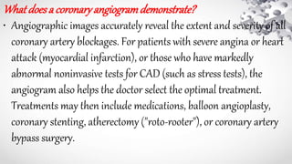 Angiography | PPTX