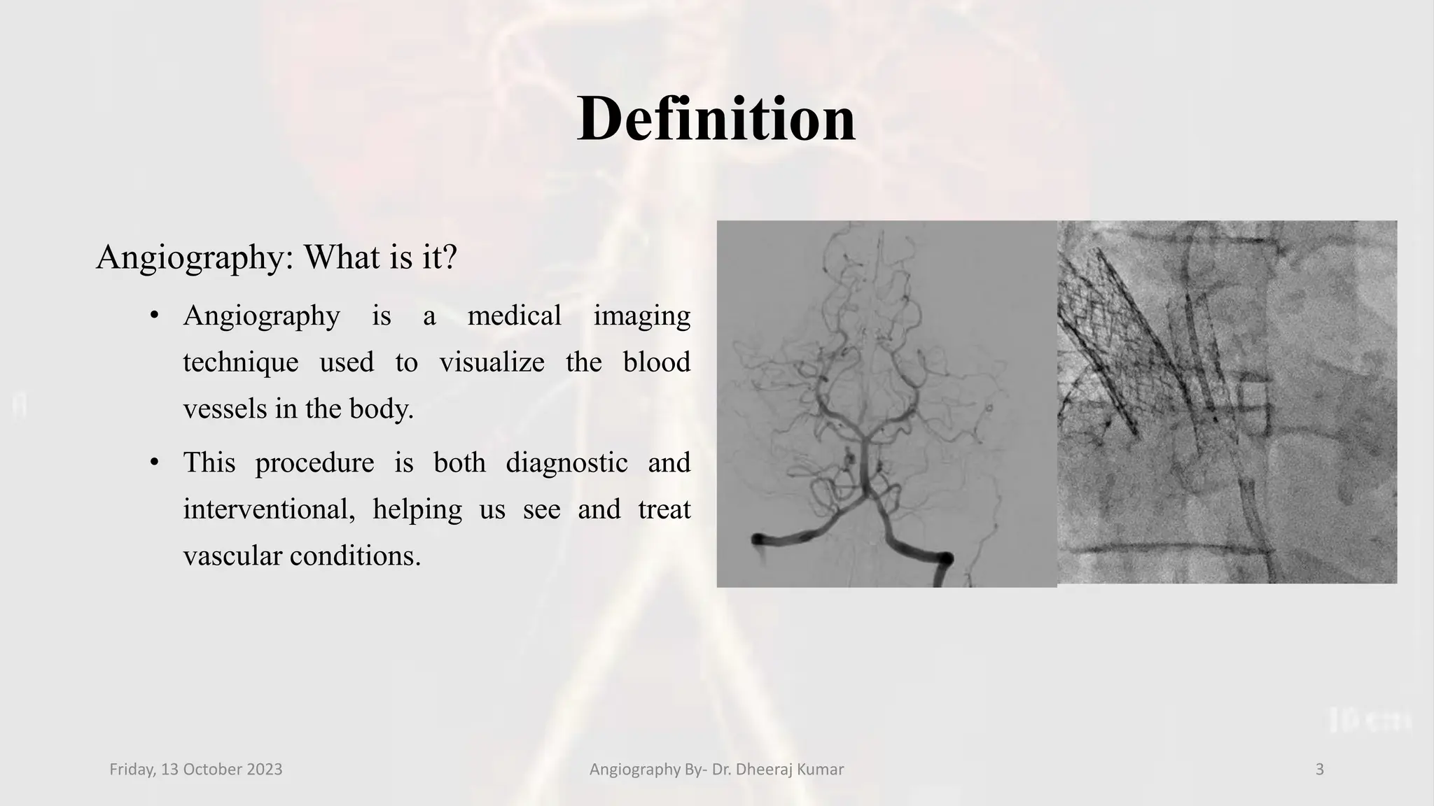 Angiography.pptx