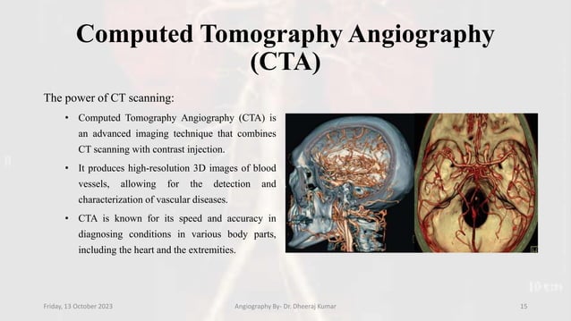 Angiography.pptx