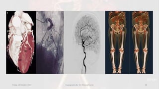 Angiography.pptx