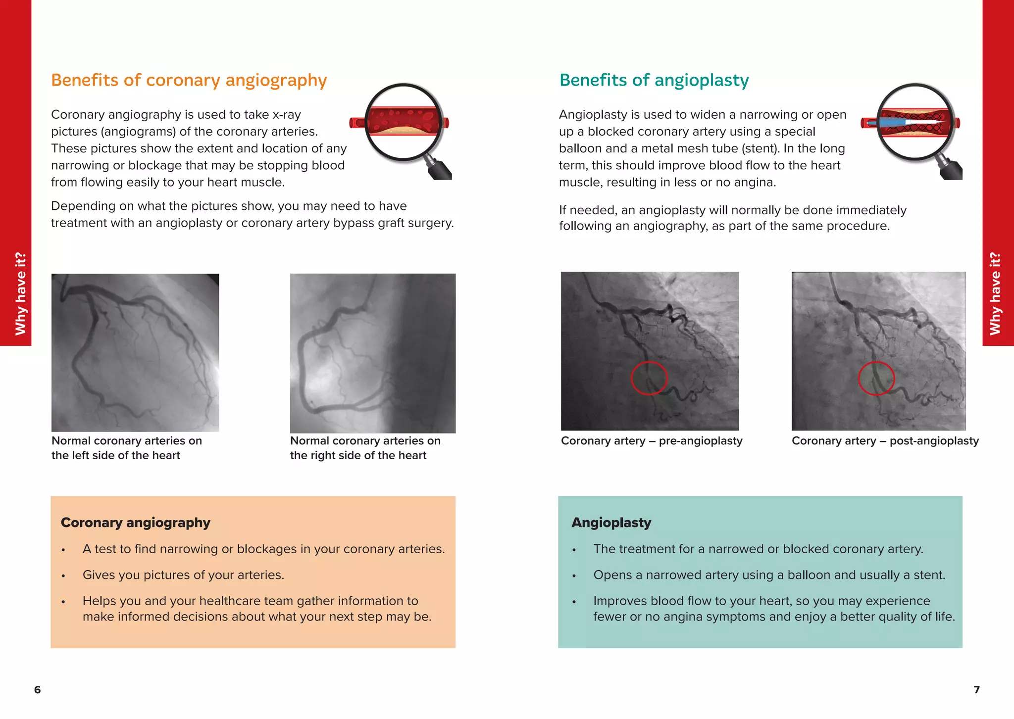 angiography-and-angioplasty-2018.pdf