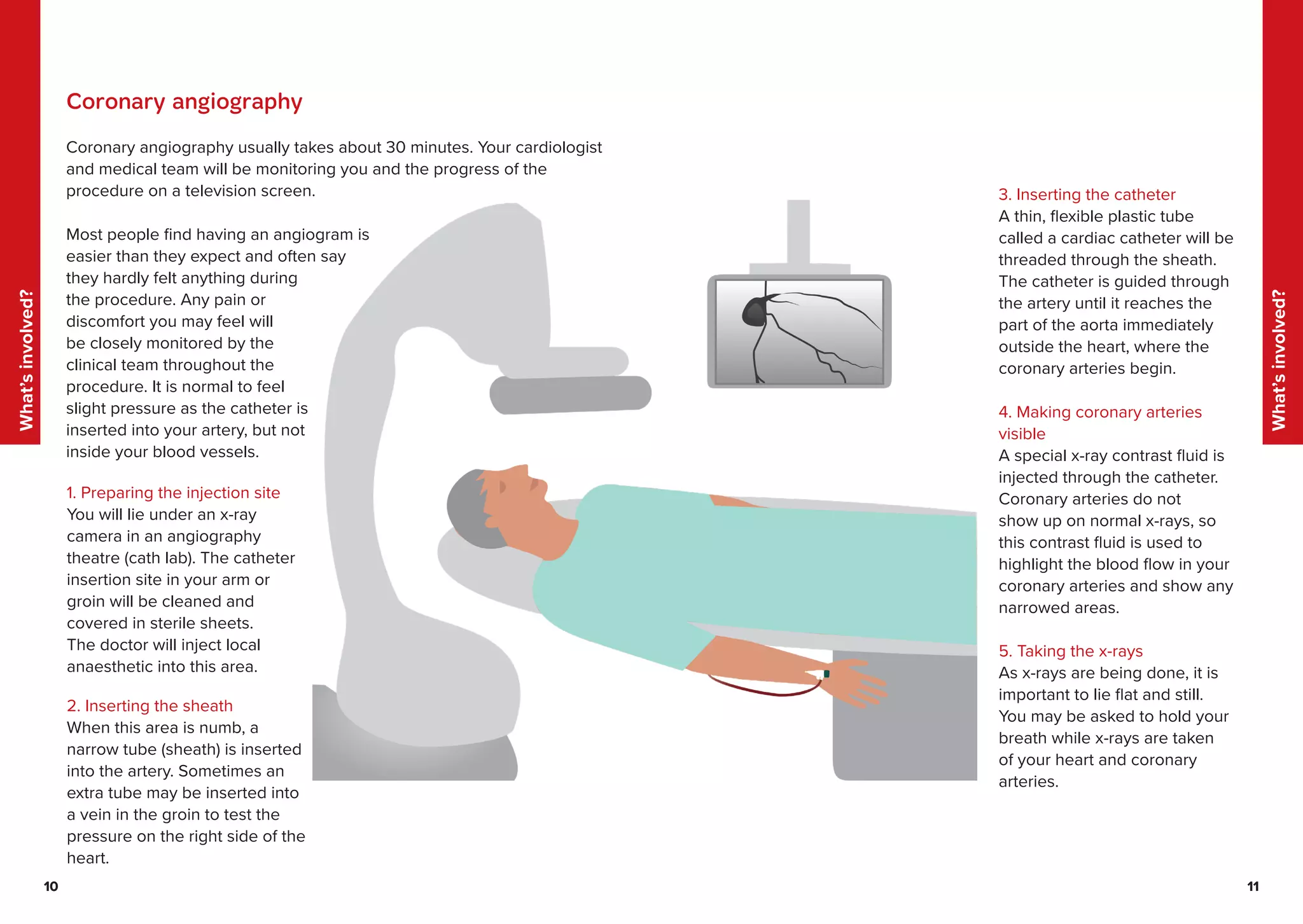 angiography-and-angioplasty-2018.pdf