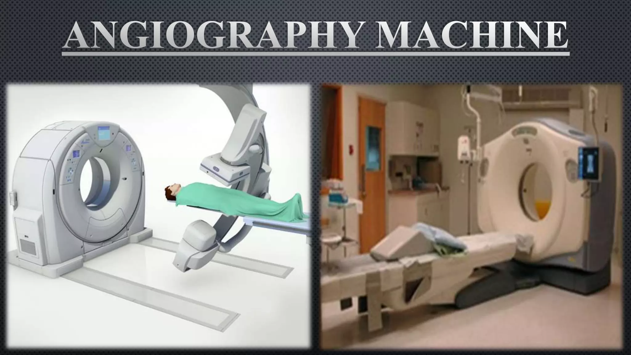 Angiography in radiology | PPTX