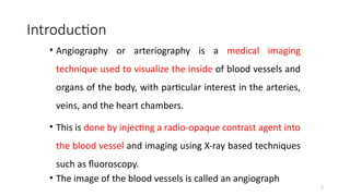 Angiography,blood vessels, recording, radiological equipment | PPTX