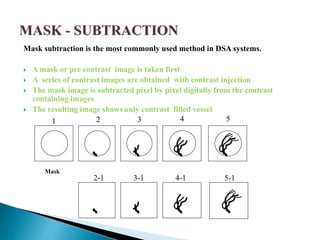 ANGIOGRAPHY 5418.pptx
