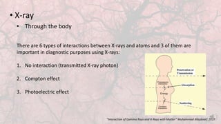 Comprehensive Overview of Angiography: X-ray Production, Imaging, and ...