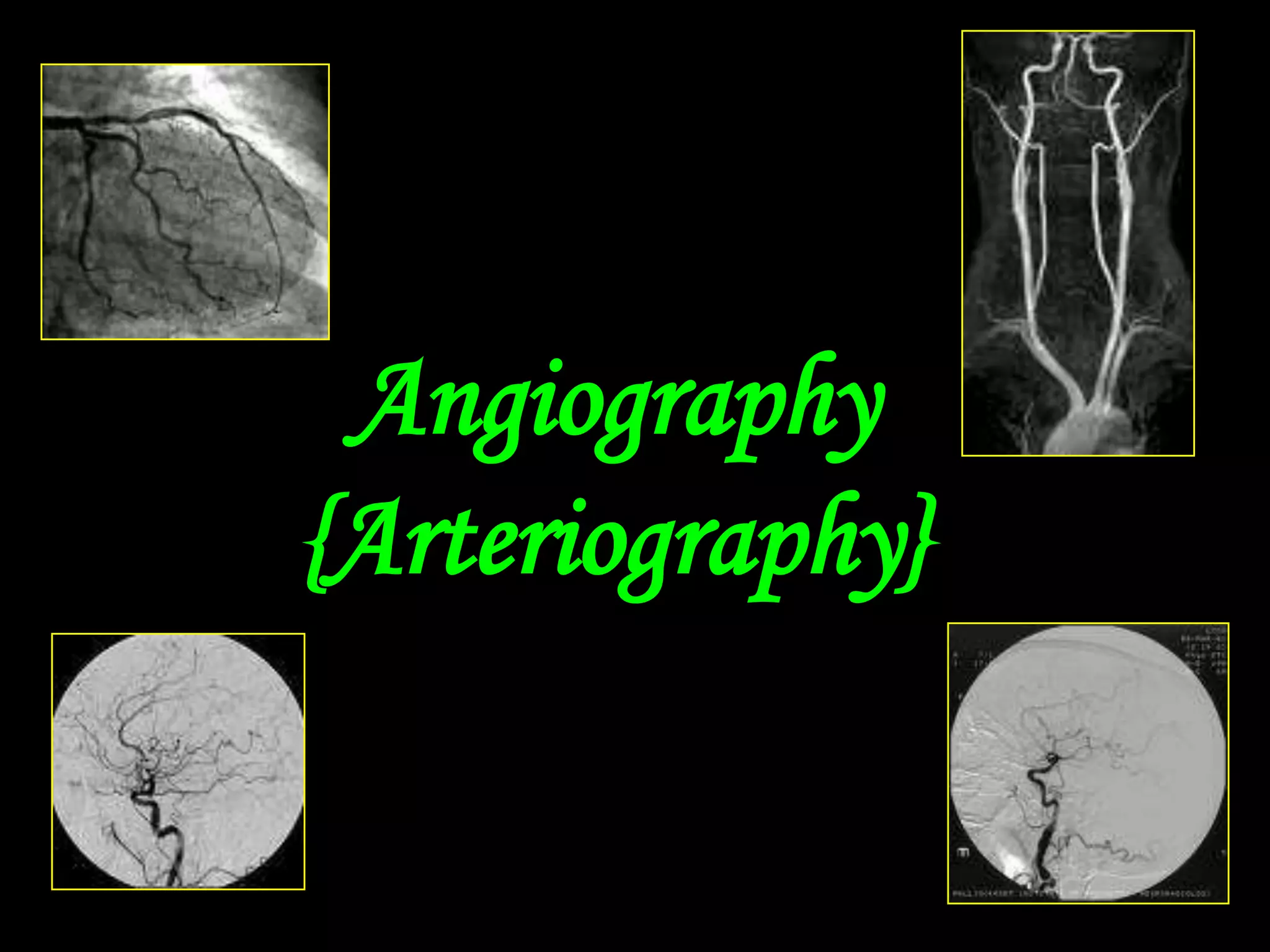 Angiography {arteriography} | PPSX
