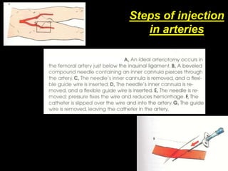 Angiography {arteriography} | PPSX