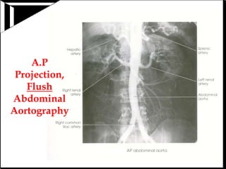 Angiography {arteriography} | PPSX