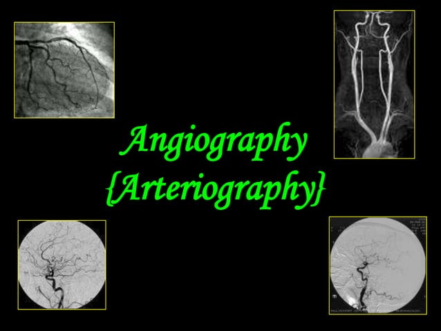 Angiography {arteriography} | PPSX | Heart and Cardiovascular Diseases ...