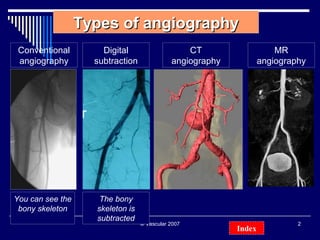 Angiography basics and seldinger technique | PPT