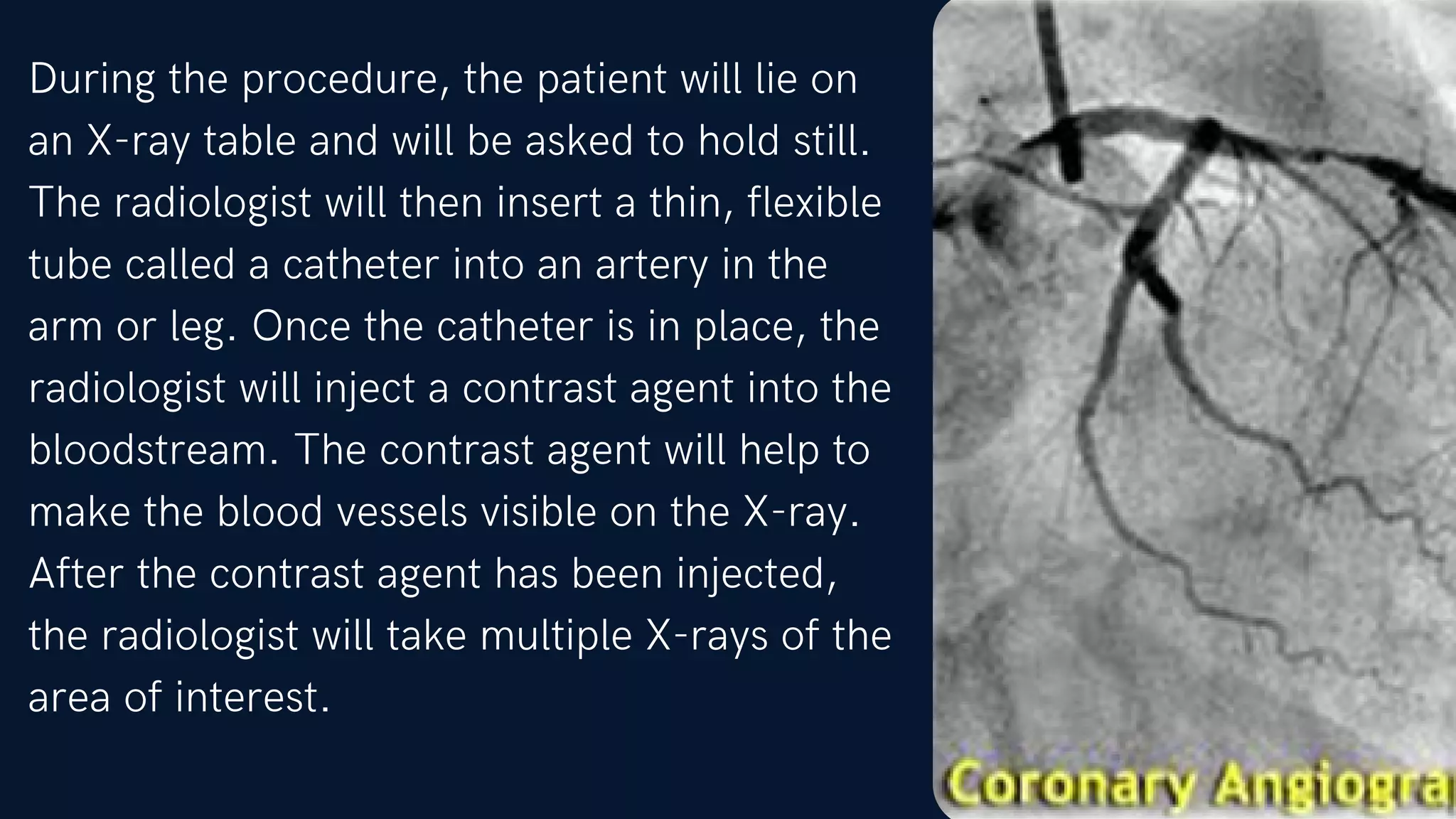 Angiography in India, Cost of Angiography in India.pdf