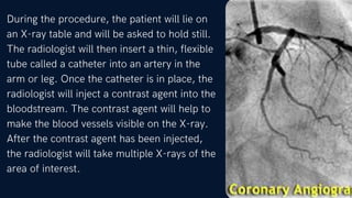 Angiography in India, Cost of Angiography in India.pdf