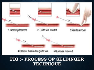 Angiography of Head and Neck | PPTX