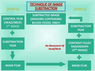 Angiography of Head and Neck | PPTX