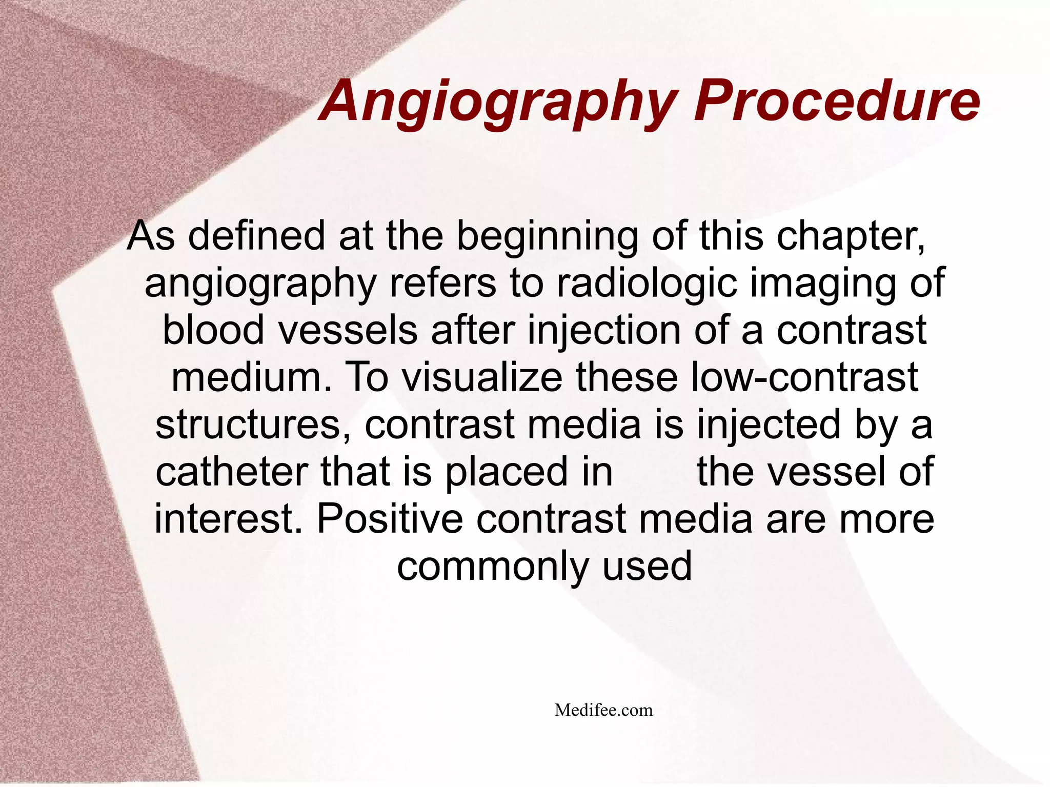 Angiography surgery in india | PPT