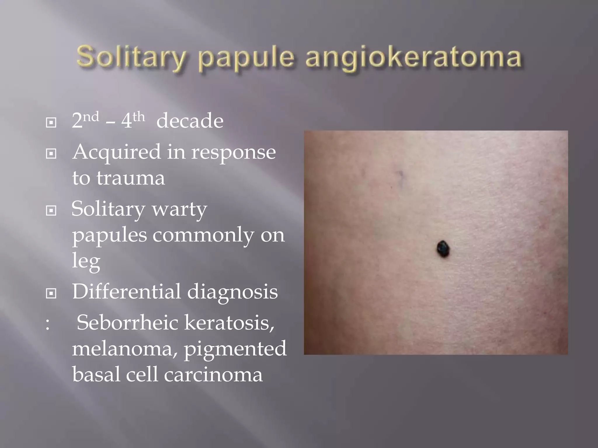 Angiokertoma & fabrys disease | PPTX