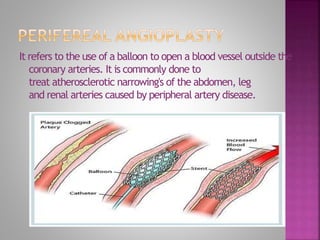 Angioplasty & Stents | PPTX