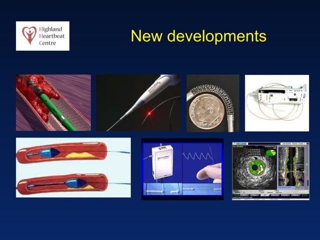 Angioplasty Ppt Free Download