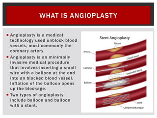Angioplasty | PPTX