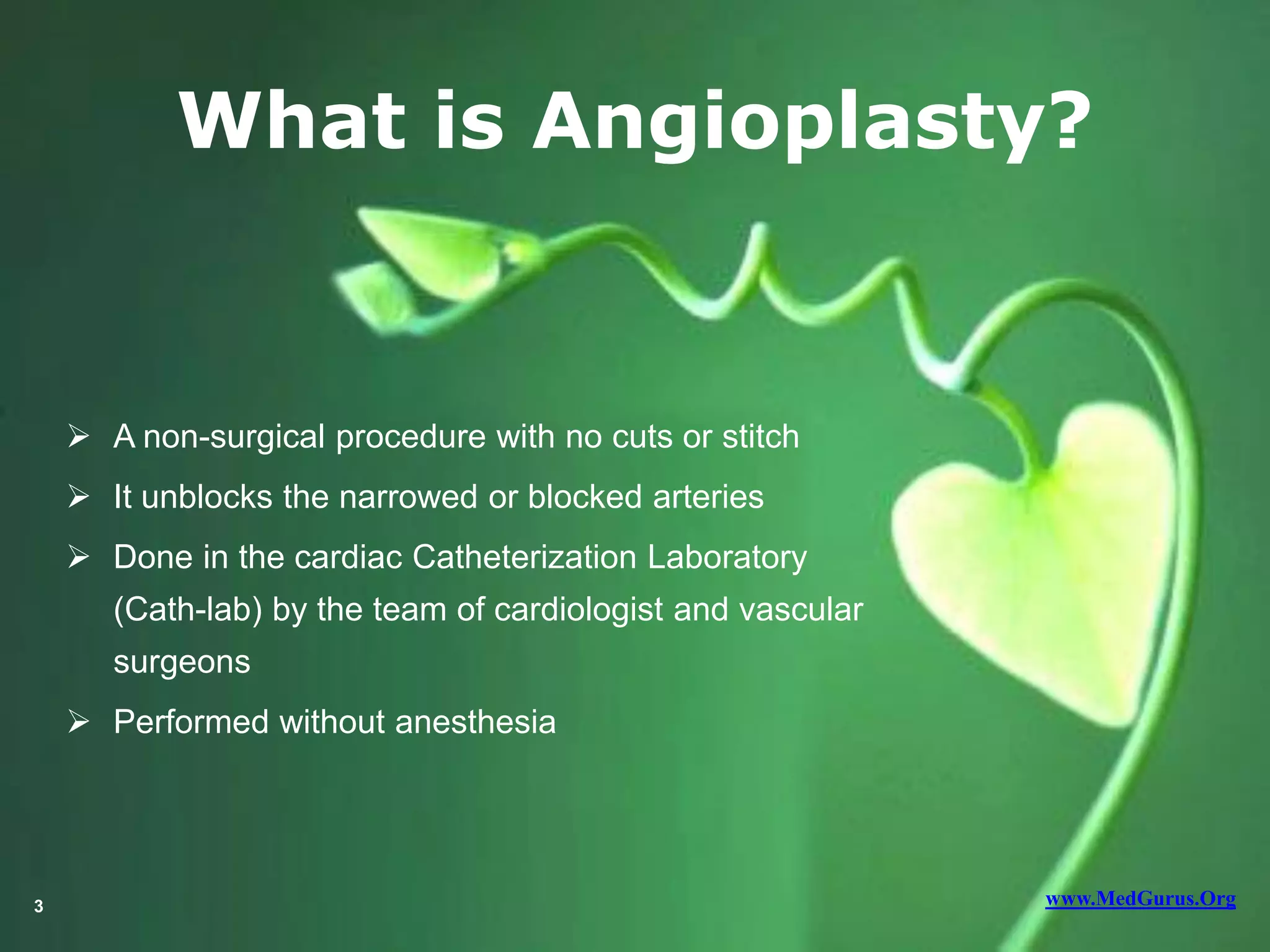 Facts on Angioplasty | PDF